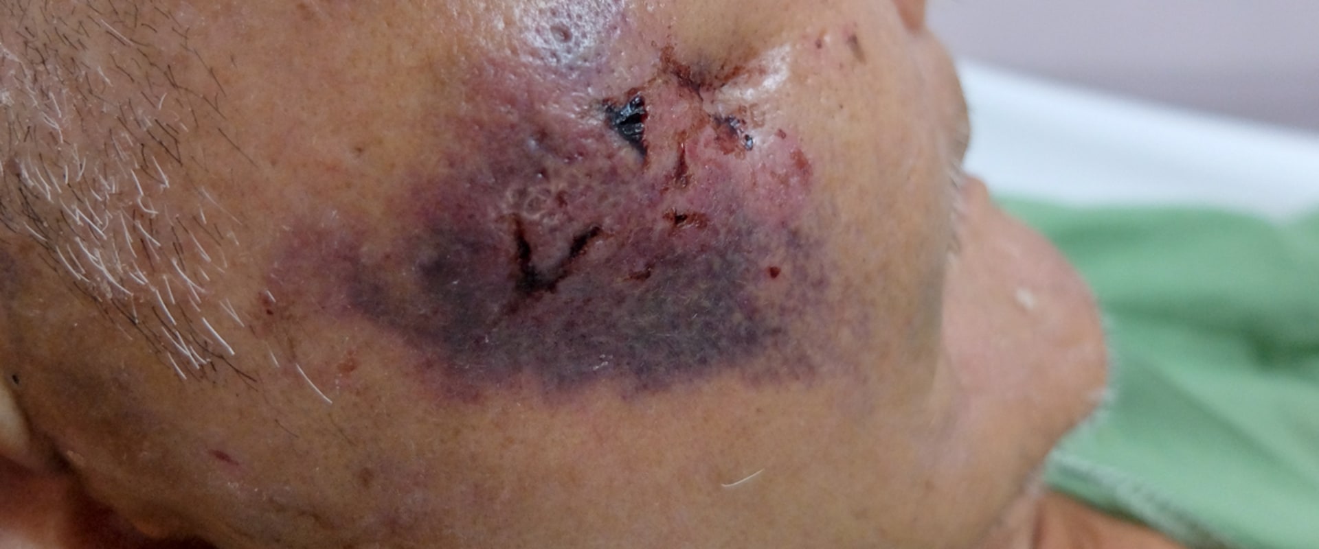 The Most Dangerous Plastic Surgeries and Their Complications