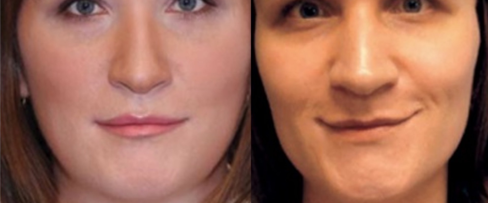 The Two Main Types of Plastic Surgery: A Comprehensive Guide